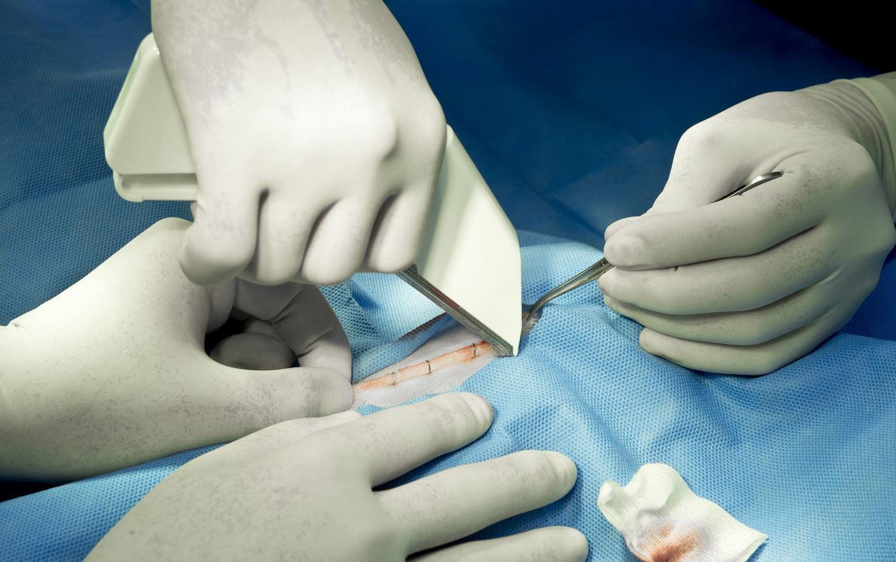 Did Your Surgeon Use This Defective Tool Did Your Surgeon Use This Defective Tool